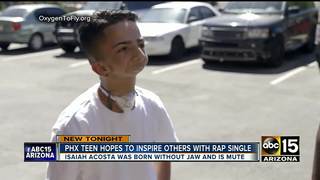 Phoenix teen Isaiah Acosta, born without a jaw, achieves dream of ...